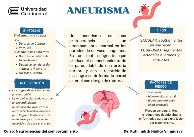 Tratamientos y Síntomas del Aneurisma | PDF