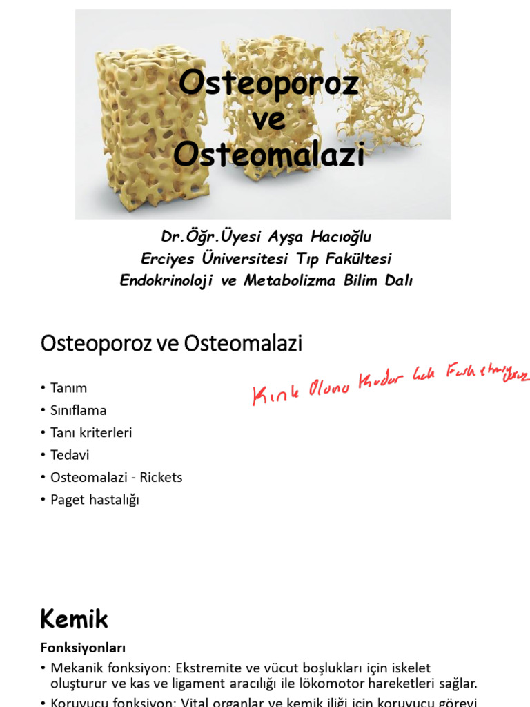 80 AHacıoğlu - Osteoporoz Ve Osteomalazi_231211_085713 (1) | PDF