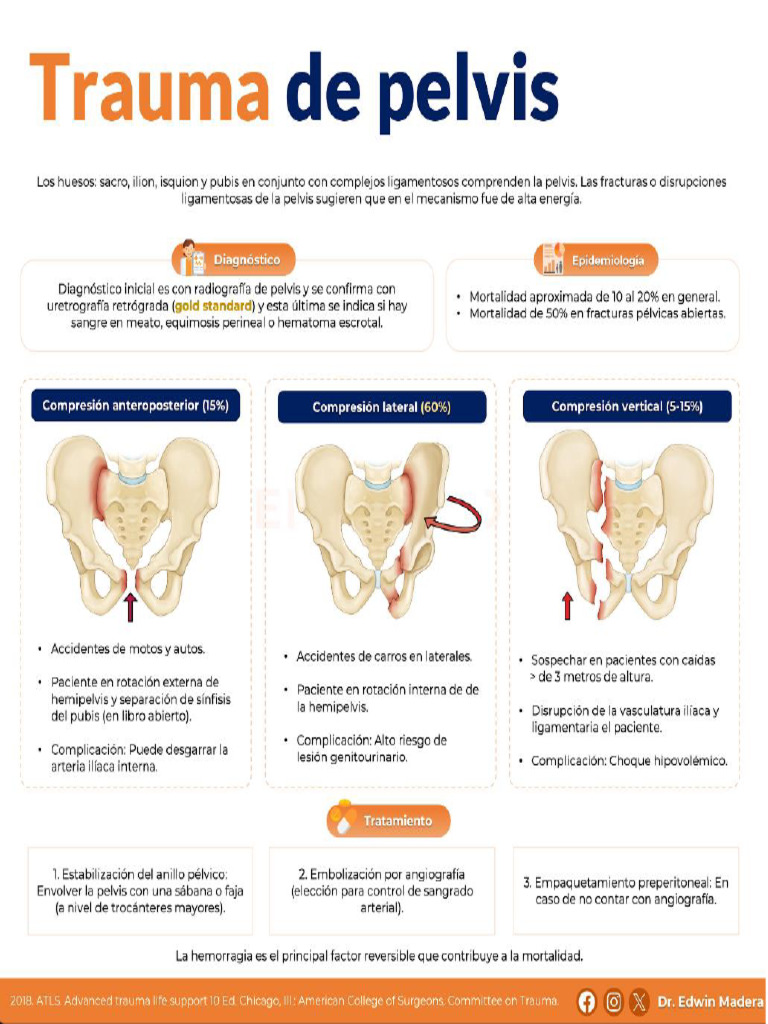 Trauma de Pelvis | PDF
