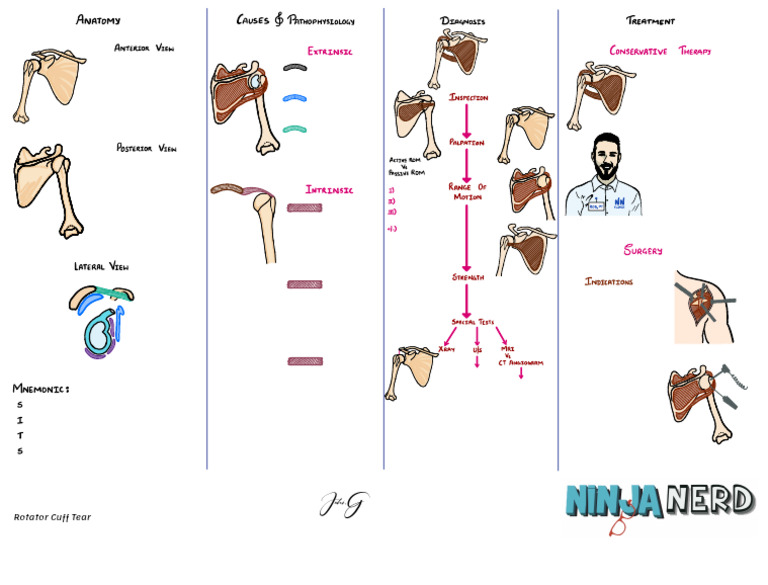 Rotator Cuff Tear Etiology, Pathophysiology, Diagnosis, Treatment and ...