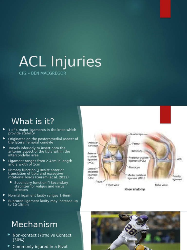 ACL Injuries: Cp2 - Ben Macgregor | PDF | Musculoskeletal System | Joints