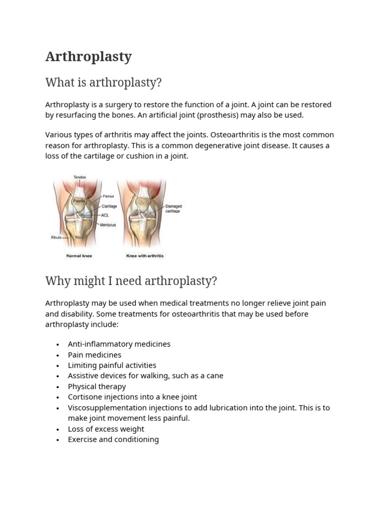 Arthroplasty: Joint Surgery Overview | PDF | Osteoarthritis | Surgery