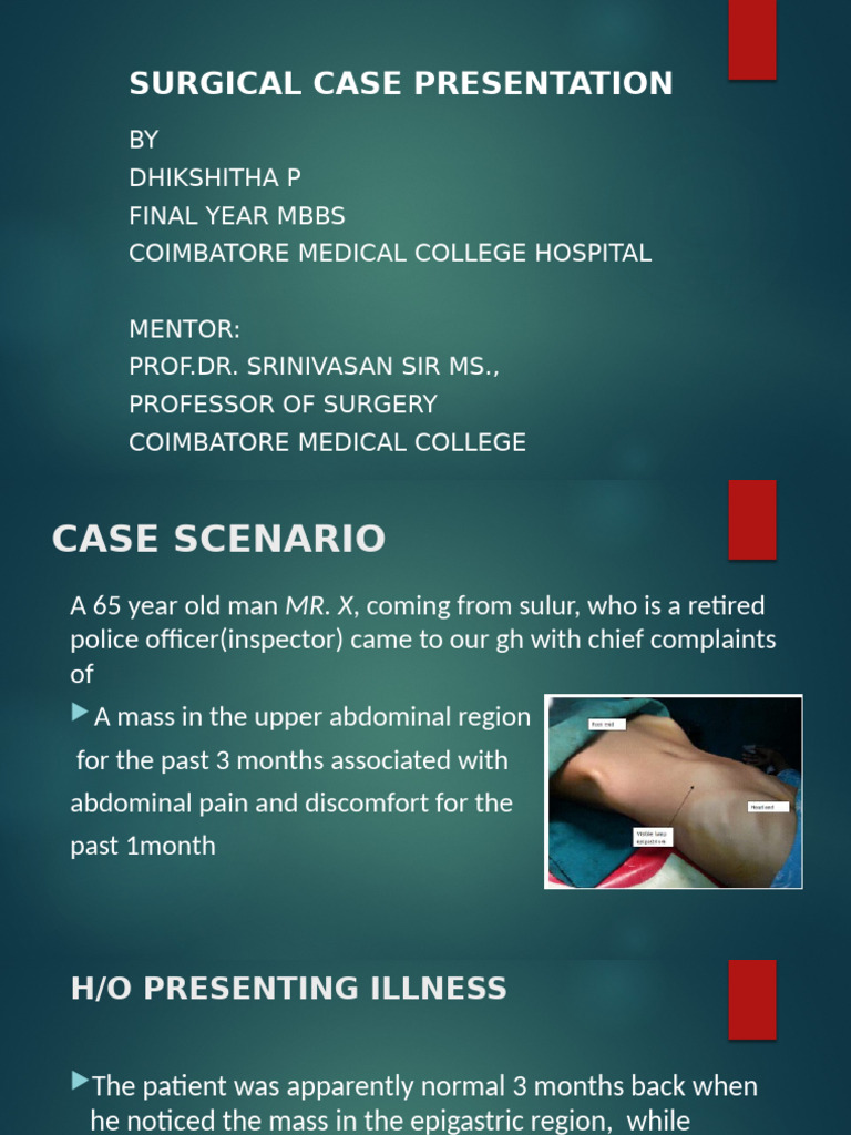 Epigastric Mass - Surgical Case Presentation | PDF | Abdomen | Medical Specialties