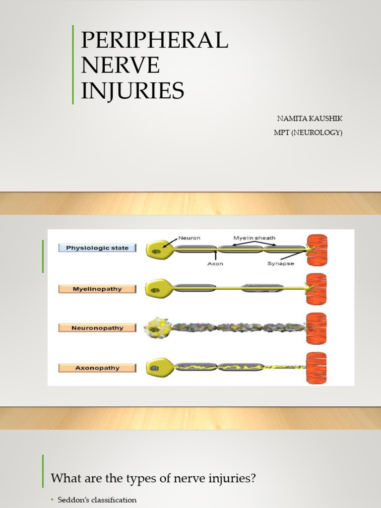 Peripheral Nerve Injuries | PDF