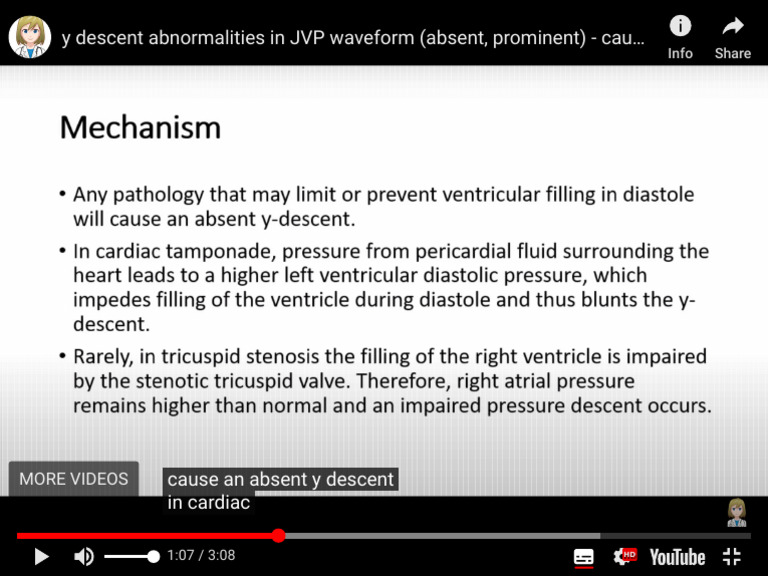 JVP Waveform Abnormalities Explained | PDF