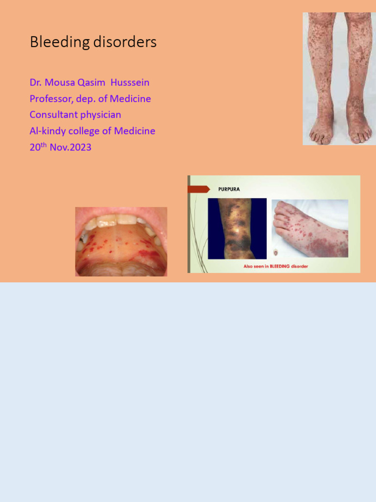 Bleeding Disorders | PDF | Platelet | Coagulation