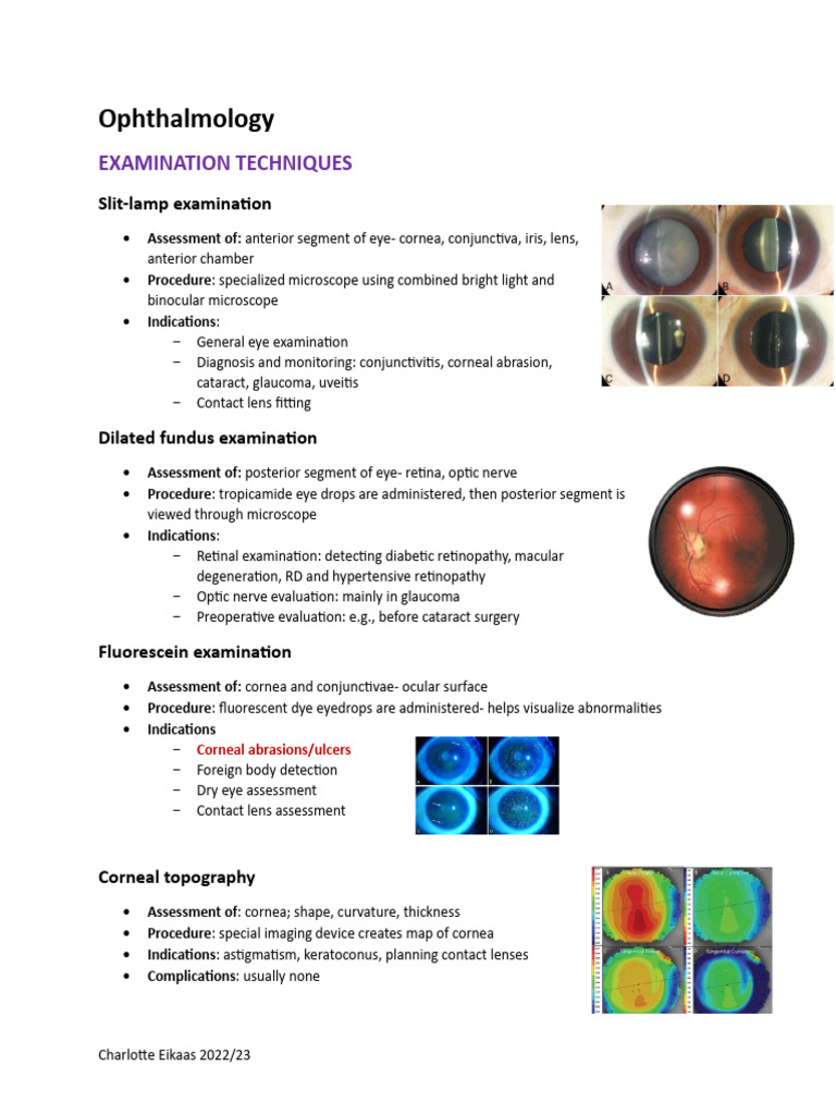 Ophthalmology Summary CE | PDF | Myopia | Glaucoma