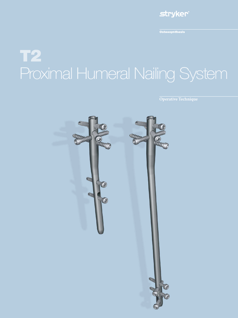 T2 Proximal Humeral Nailing System - Stryker | PDF | Screw | Orthopedic ...
