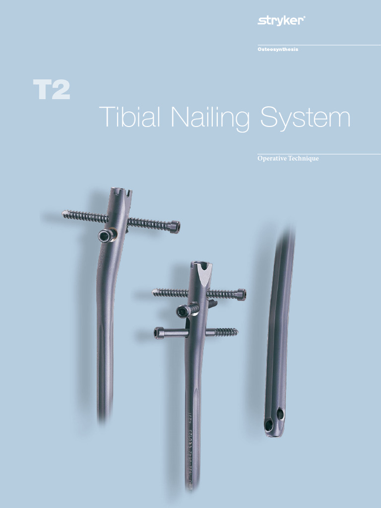 Stryker T2 Tibial Nailing Technique Guide | PDF | Anatomical Terms Of ...