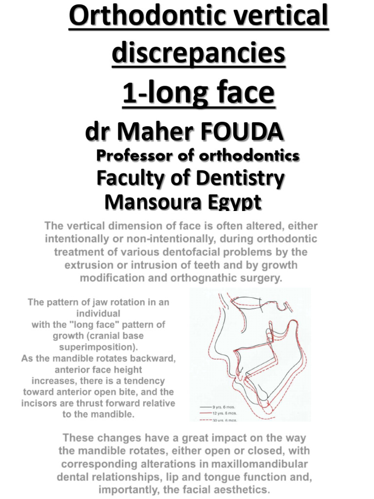 Long Face: DR Maher FOUDA | PDF | Dentistry Branches
