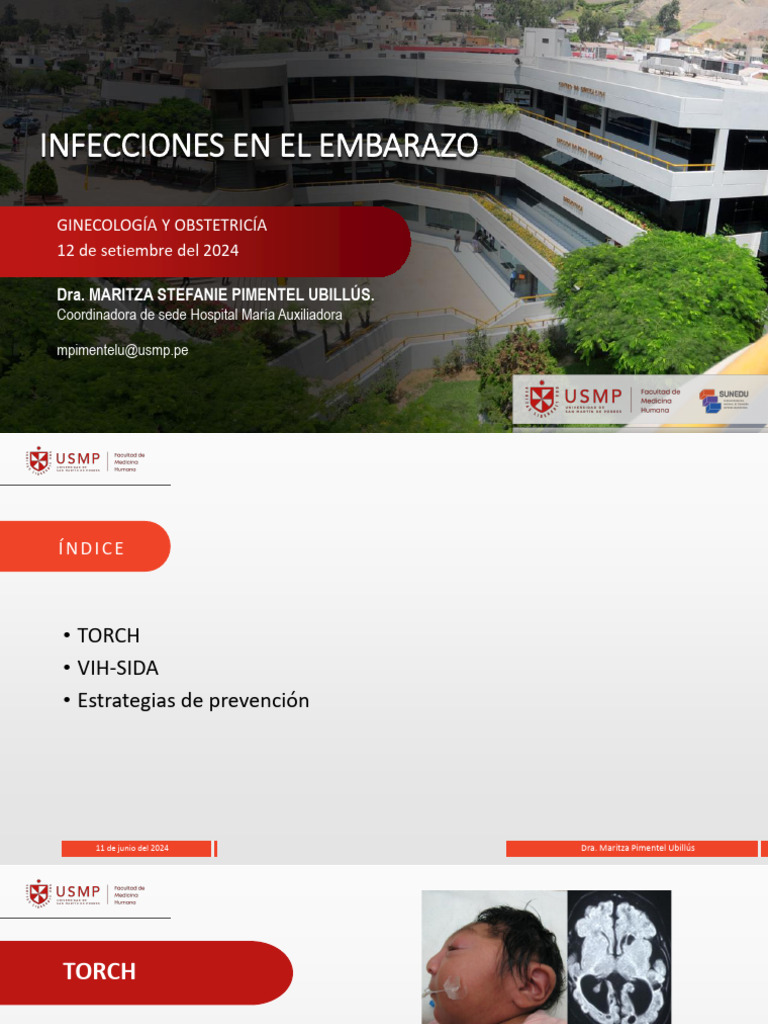 To25 Infecciones en El Embarazo Dra. Maritza Pimentel | PDF ...
