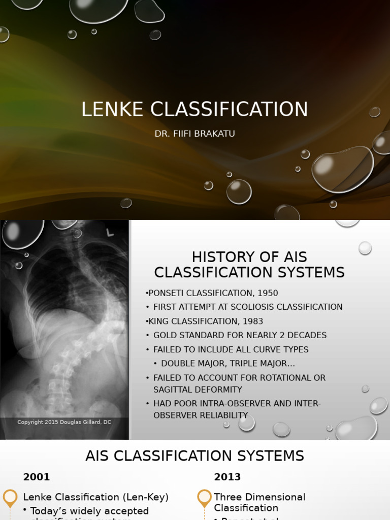 Lenke Classification | PDF | Vertebral Column | Scoliosis