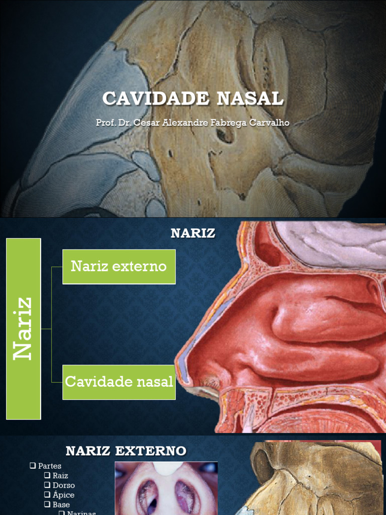 Anatomia da Cavidade Nasal | PDF | Cabeça e pescoço humano | Anatomia ...