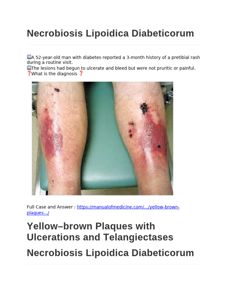Necrobiosis Lipoidica in Diabetes | PDF | Diseases And Disorders ...