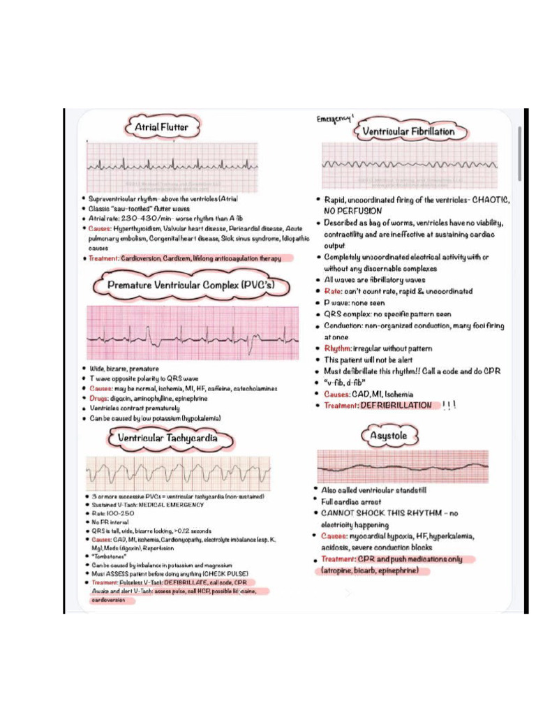 EKG Rythms Part 2 | PDF