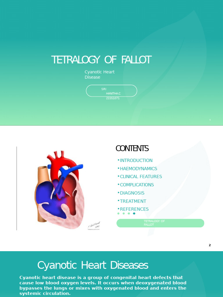 Tetralogy of Fallot | PDF | Congenital Heart Defect | Heart