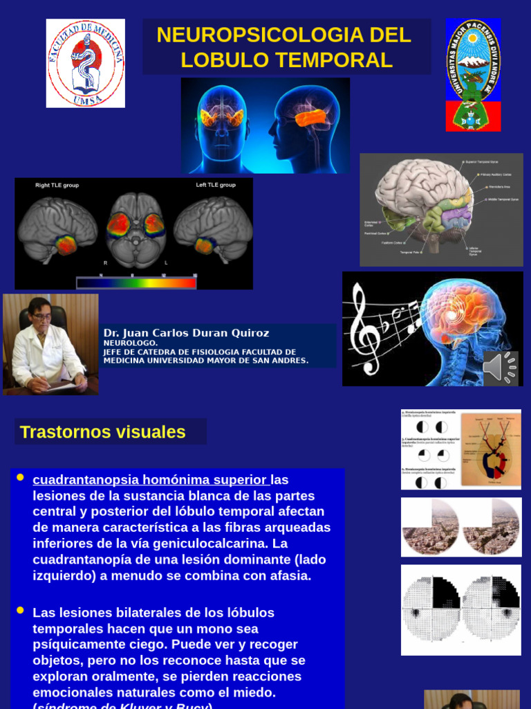 10 lobulo temporal A | PDF | Lóbulo temporal | Sonido