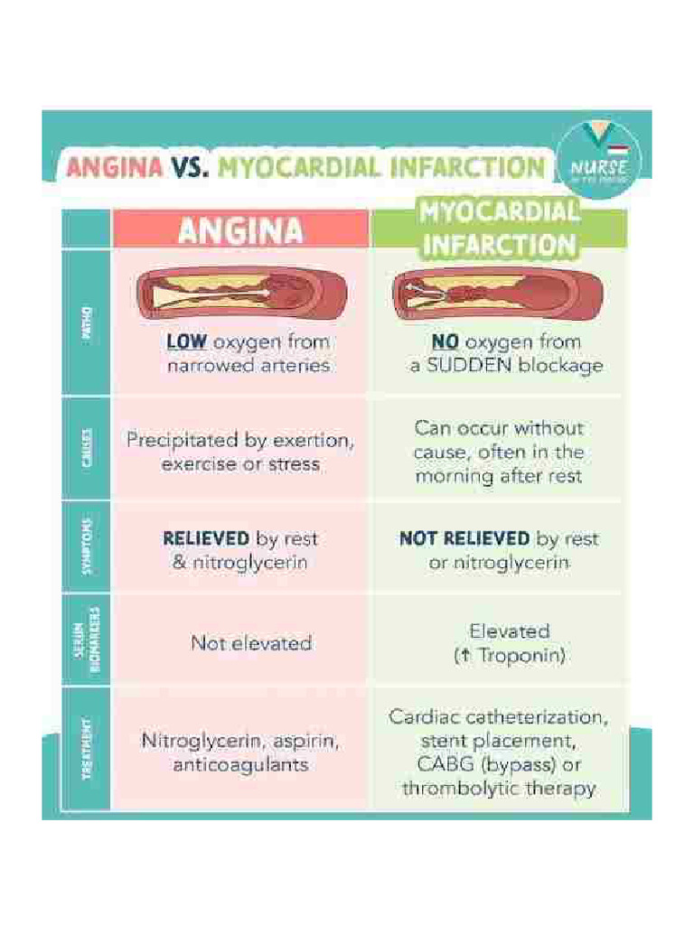 Angina Vs Myocardial Infarction | PDF