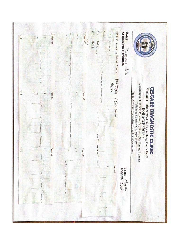 Ecg Macahia Joie c | PDF