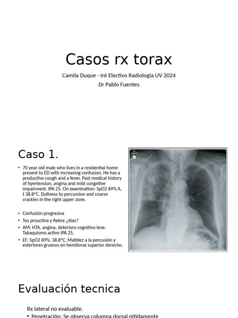 RX Torax | PDF | Pulmón | Tórax