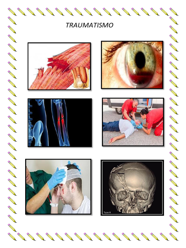 TRAUMATISMO | PDF