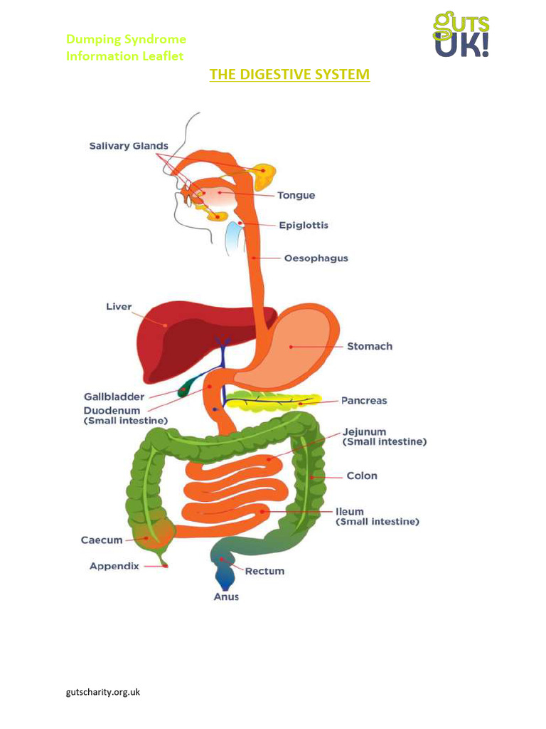 Guts-UK-Dumping-Syndrome-Leaflet | PDF | Stomach | Clinical Medicine