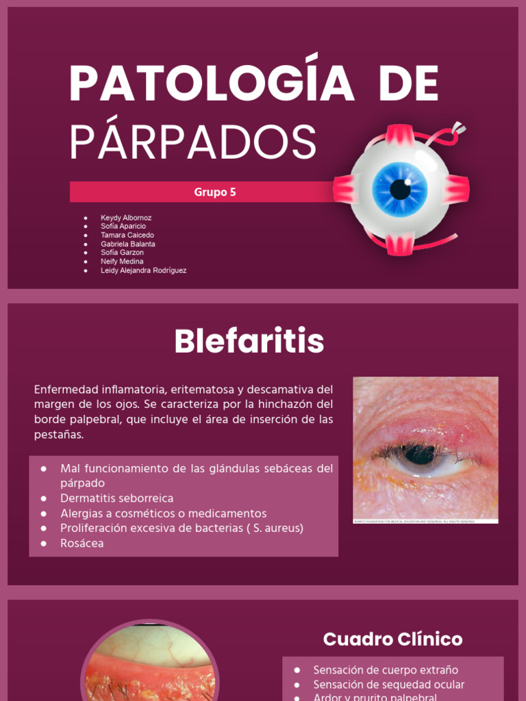 Patologías Del Párpado | PDF | Alergia | Medicina CLINICA