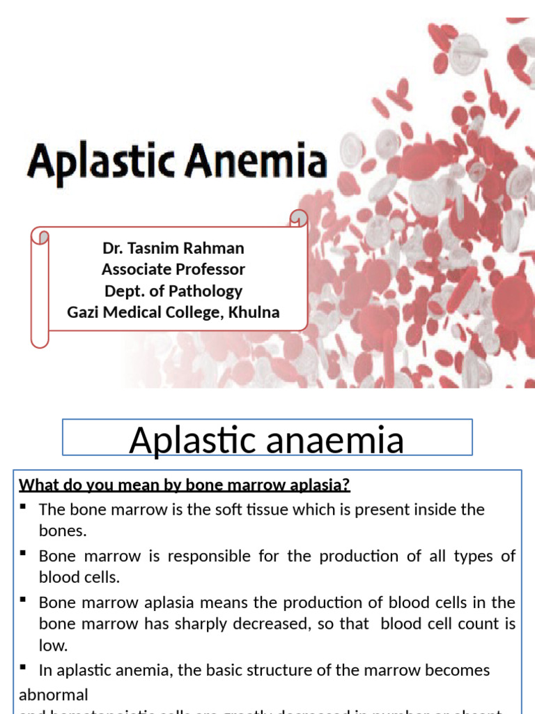 Understanding Aplastic Anemia | PDF | Bone Marrow | Anemia