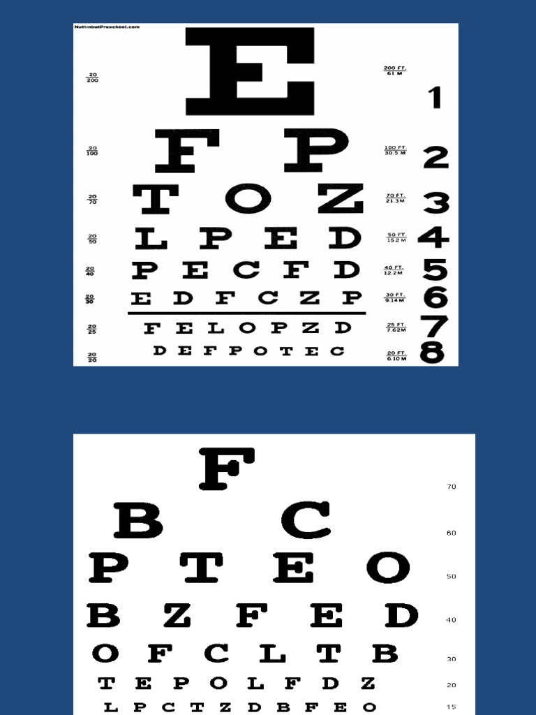 Eye Chart Alphabet - Unid 1.1 | PDF