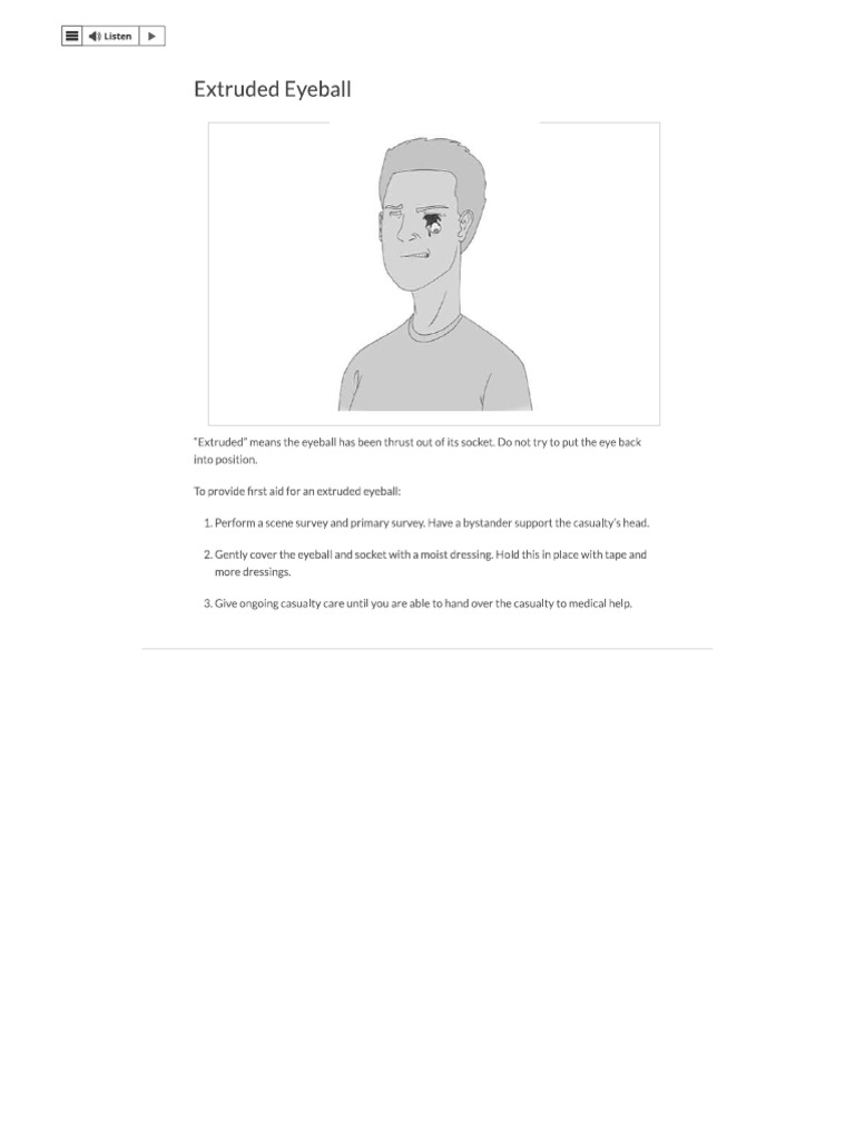 11.7 Extruded Eyeball | PDF