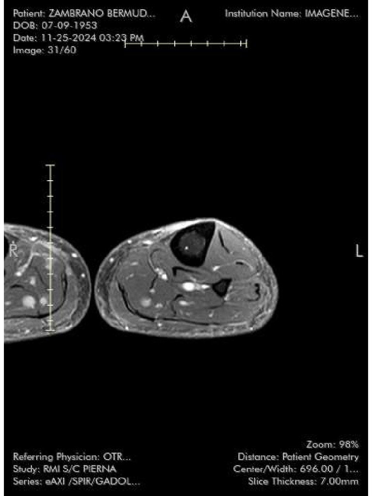 eAXI - SPIR - GADOL (31 of 60) | PDF