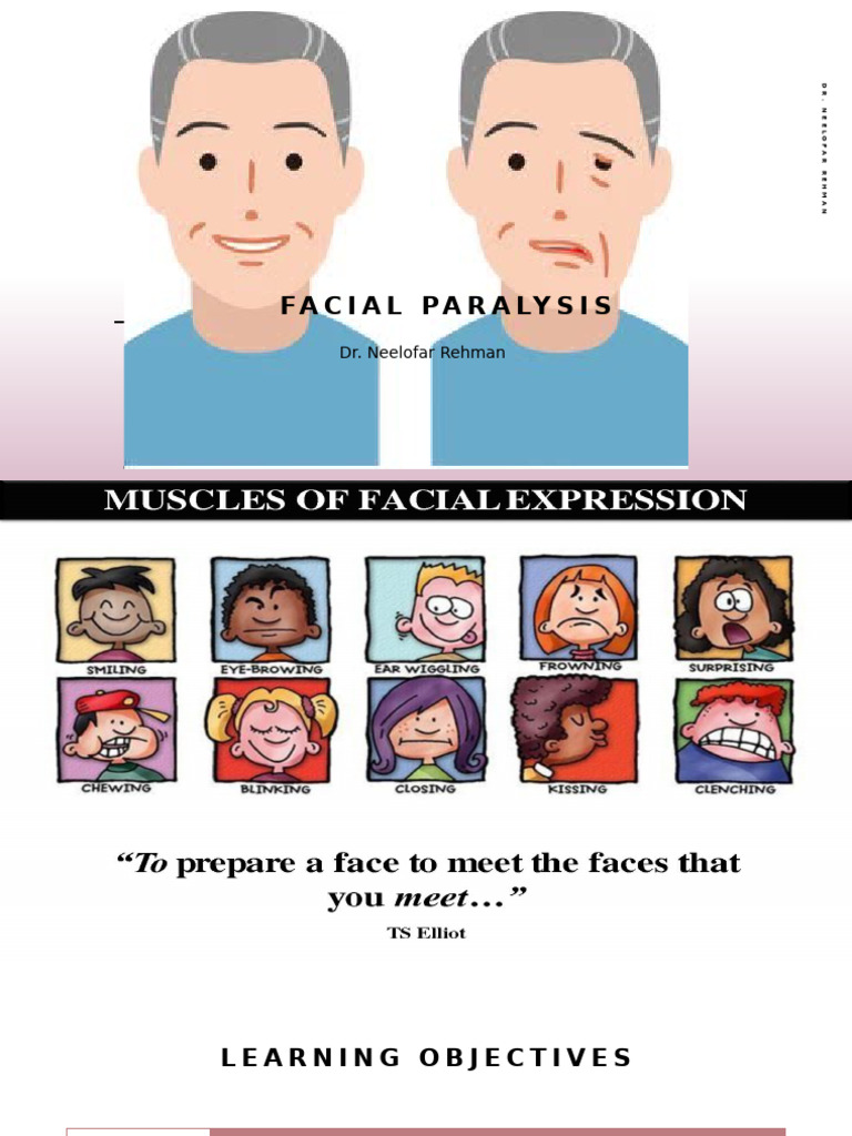 Facial Paralysis | PDF | Causes Of Death | Diseases And Disorders