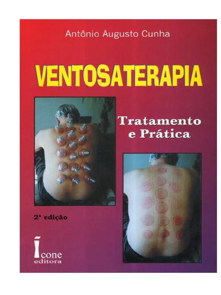 Ventosaterapia Tratamento e Pratica 2 Ed | PDF