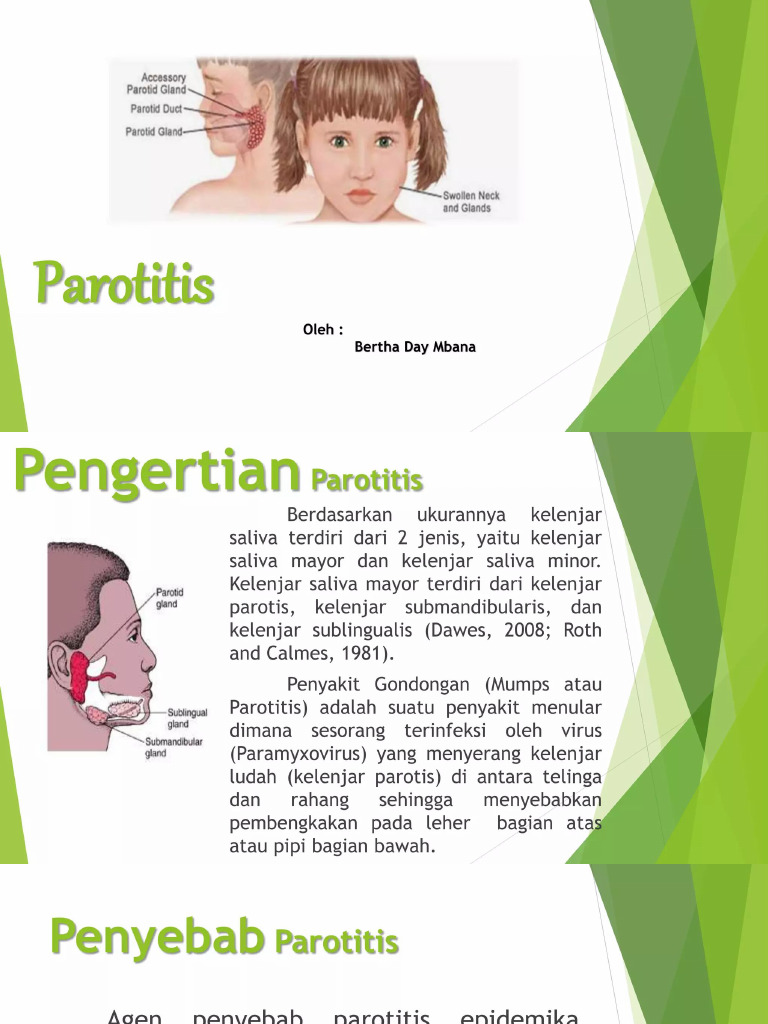 parotitis-ppt.pdf | PDF