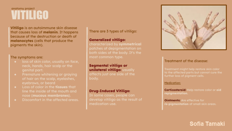 Anatomy - Vitiligo | PDF