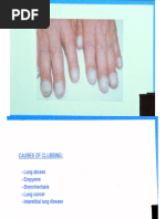 PFT Interpretation Cheat Sheet | PDF