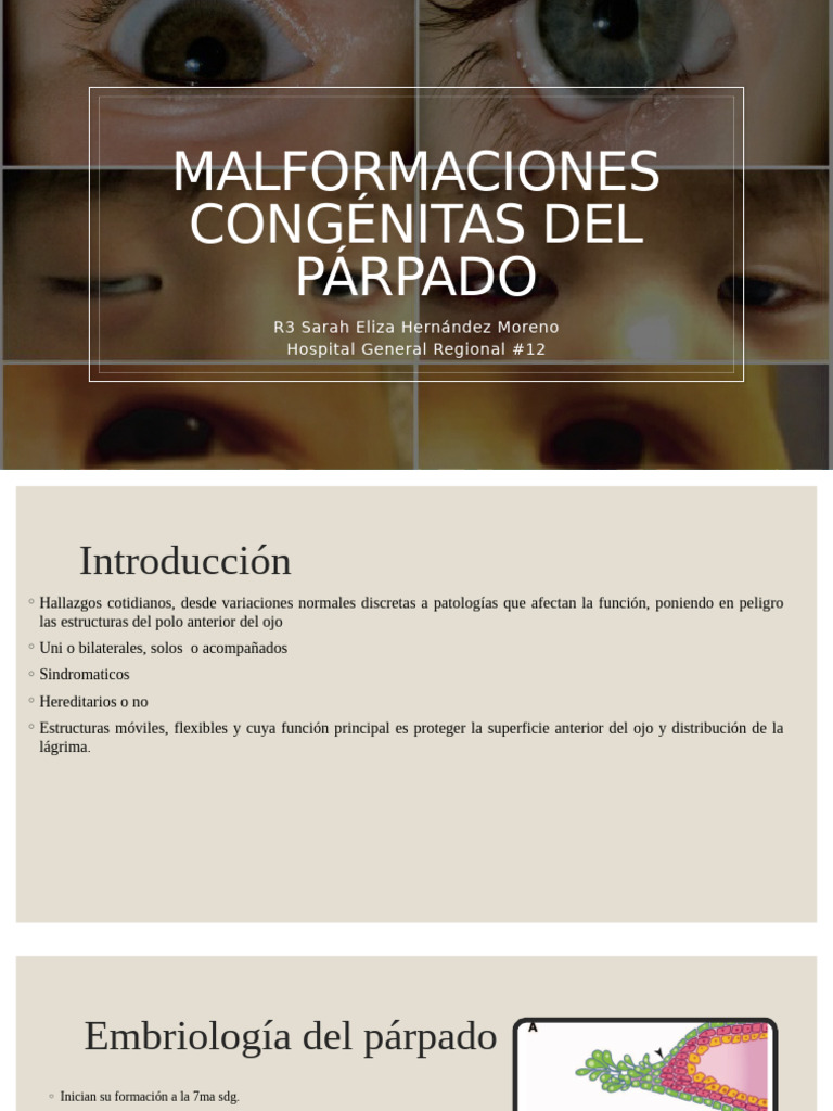 Parpado Anomalias | PDF | Oftalmología | Ojo humano