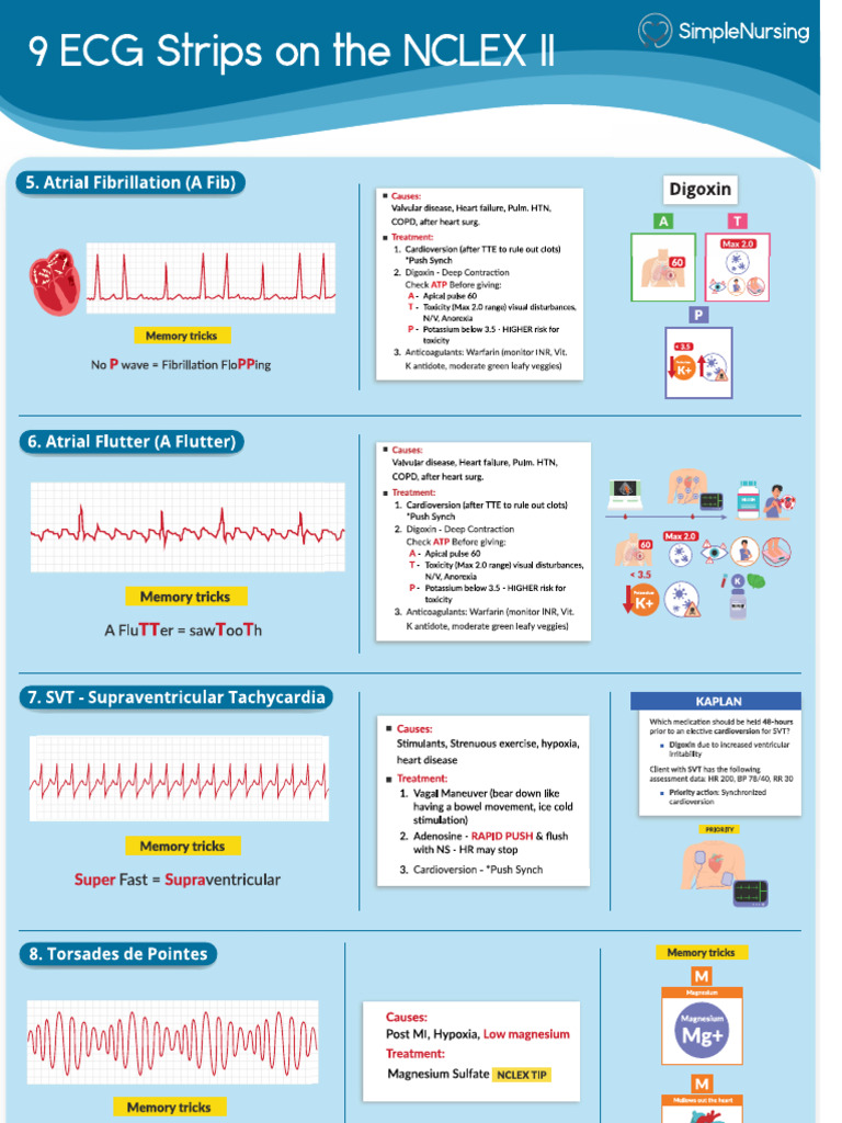 EKG basics | PDF