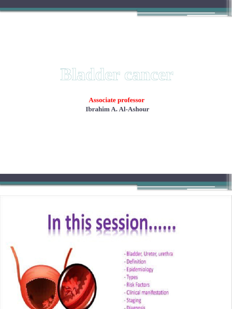 Cancer of The Bladder | PDF