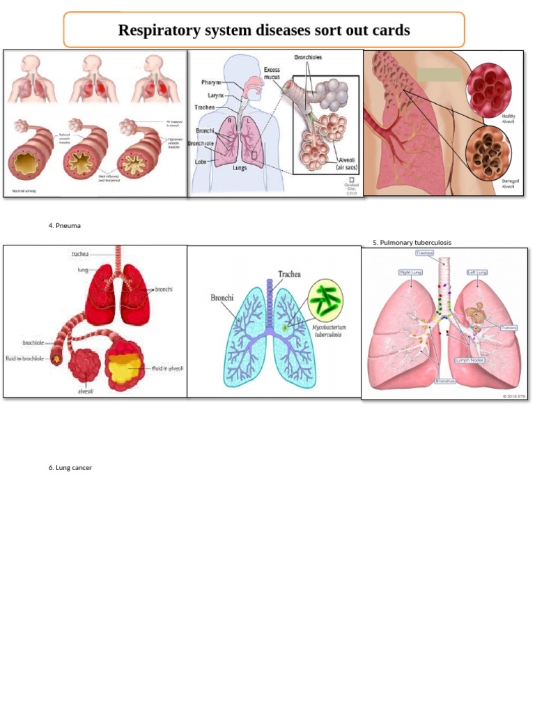 Respiratory System Diseases | PDF