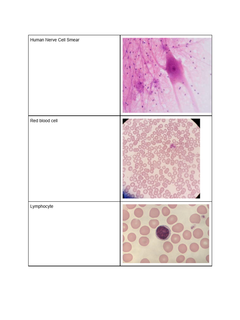 Histo Pics 2 | PDF | Lymph Node | Skin