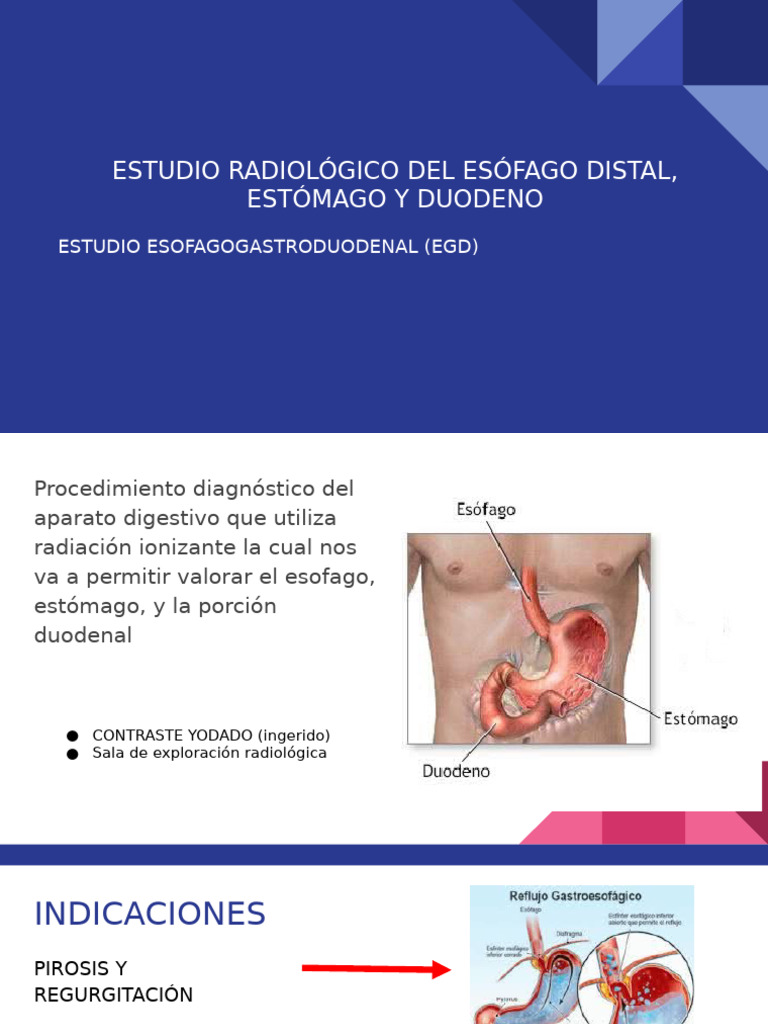 Estudio Radiológico Del Esófago Distal, Estómago y Duodeno | PDF | La ...