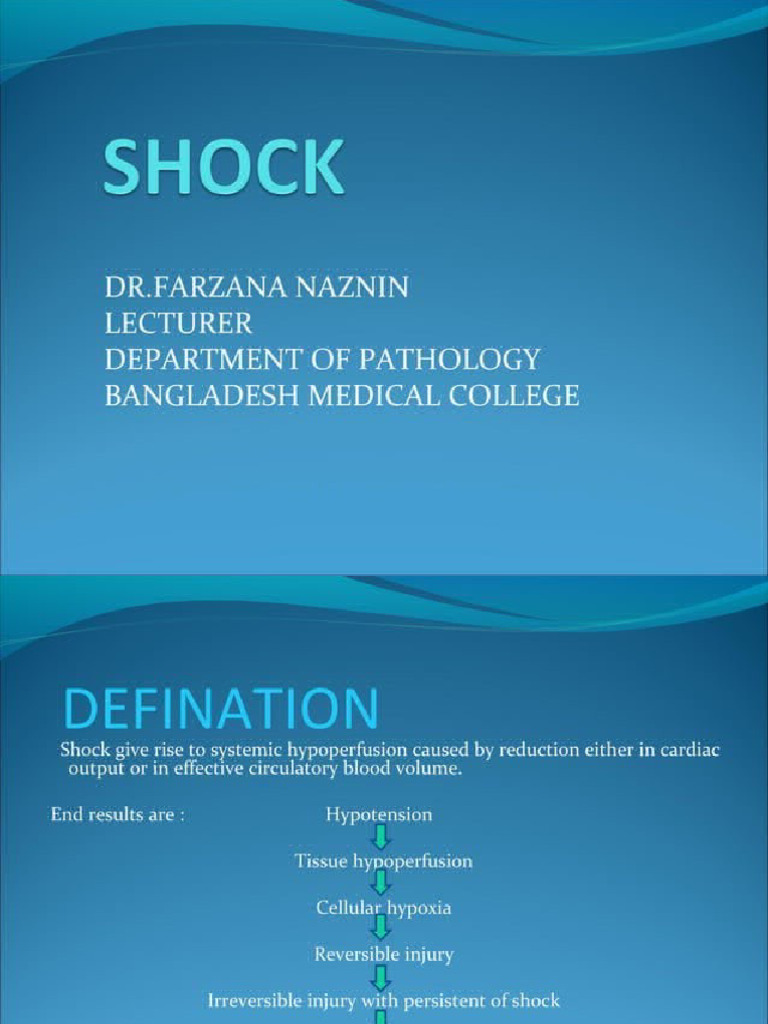 Shock | PDF