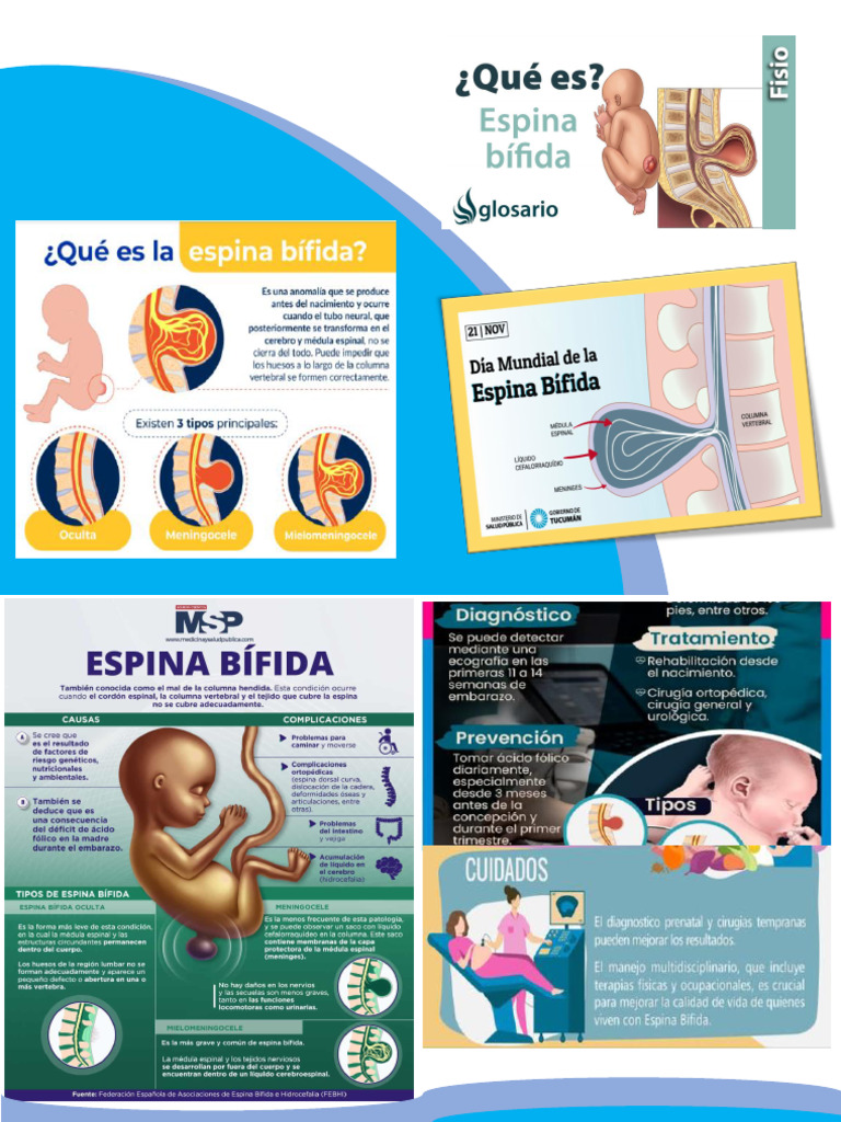 diptico de espina bifeda | PDF
