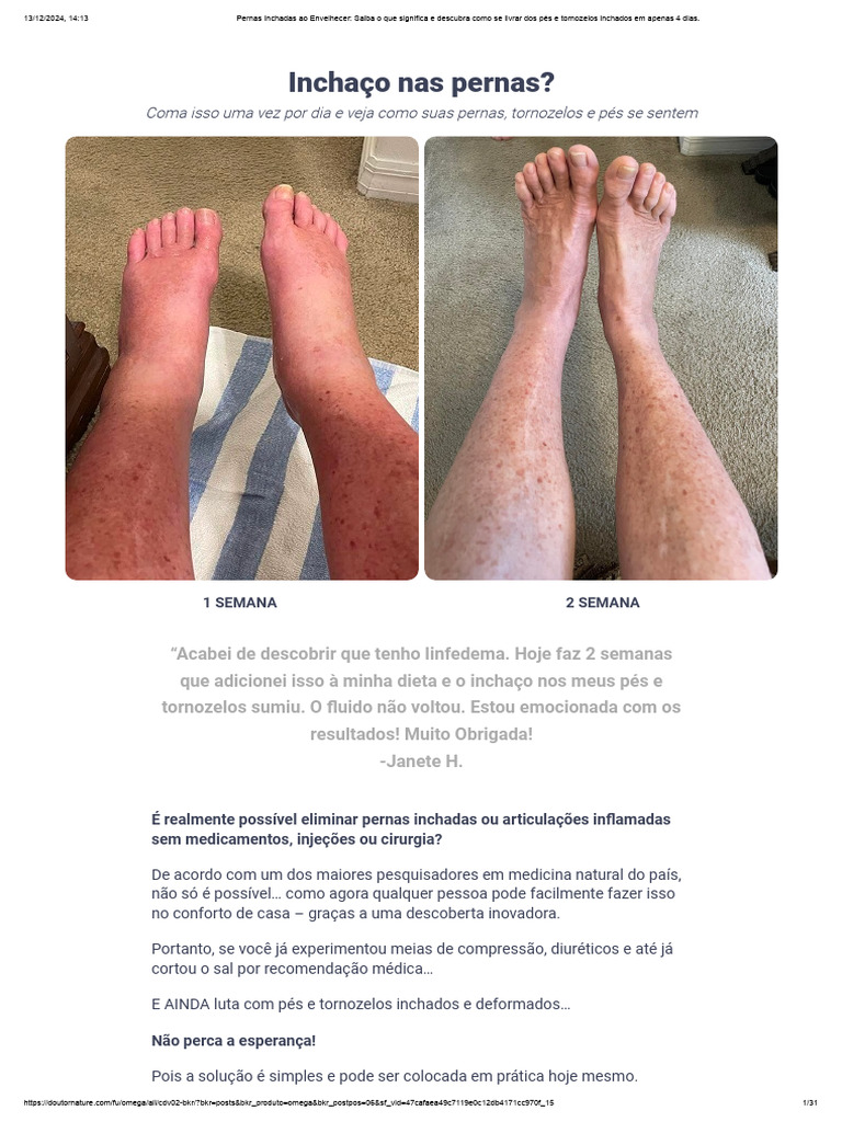 Pernas Inchadas Ao Envelhecer - Saiba o Que Significa e Descubra Como ...