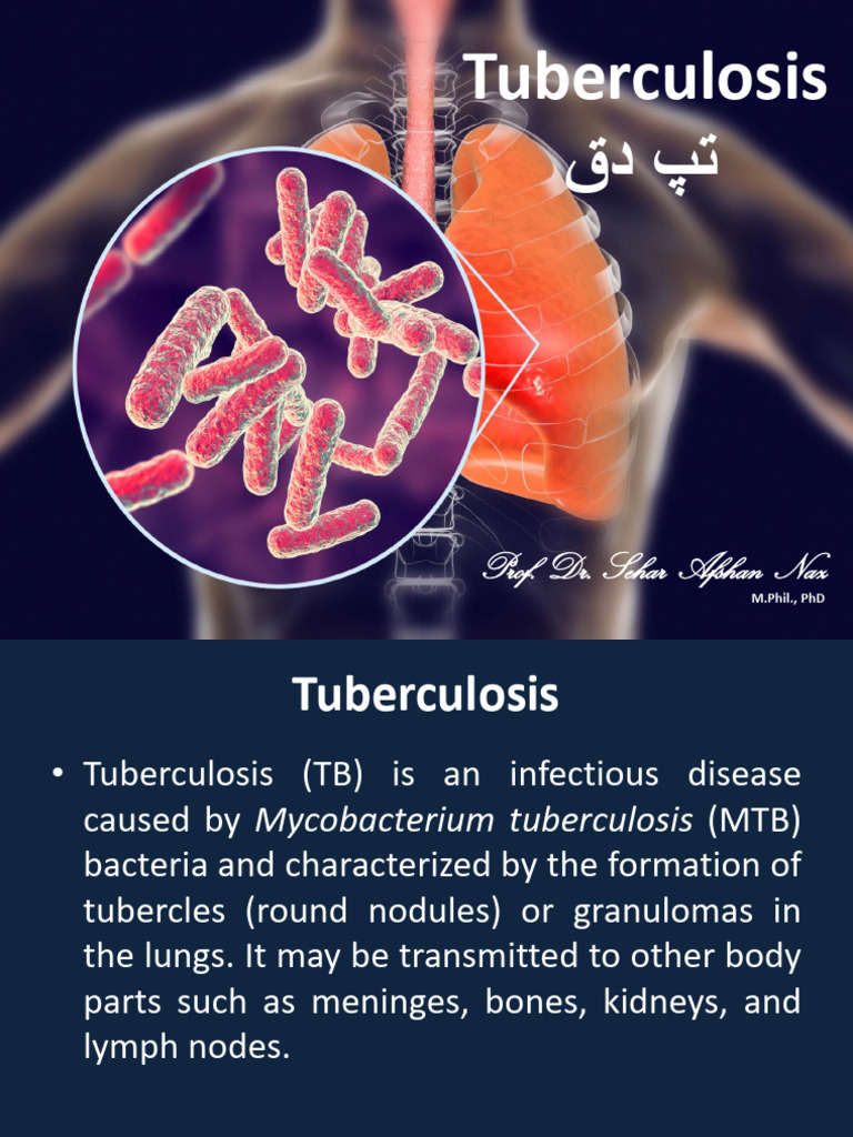Tuberculosis | PDF | Tuberculosis | Mycobacterium Tuberculosis