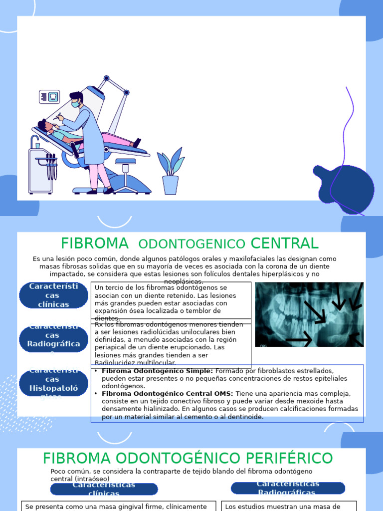Fibromas Odontogénicos: Guía Clínica | PDF | Hueso | Tejido conectivo
