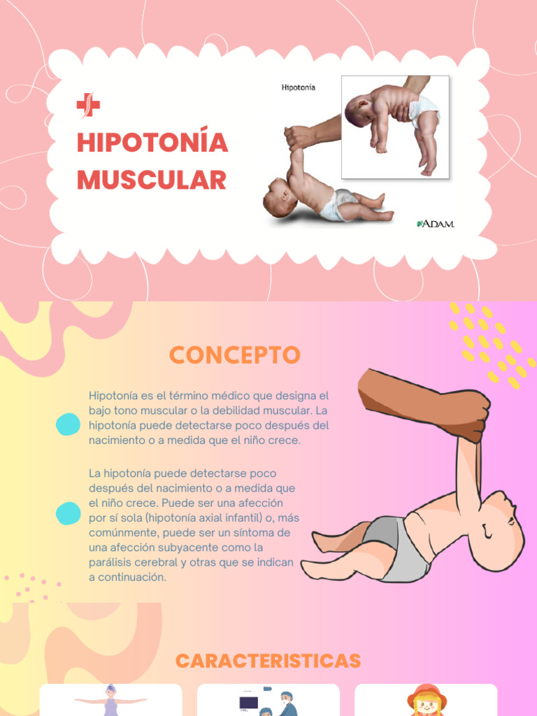 HIPOTONIA | PDF