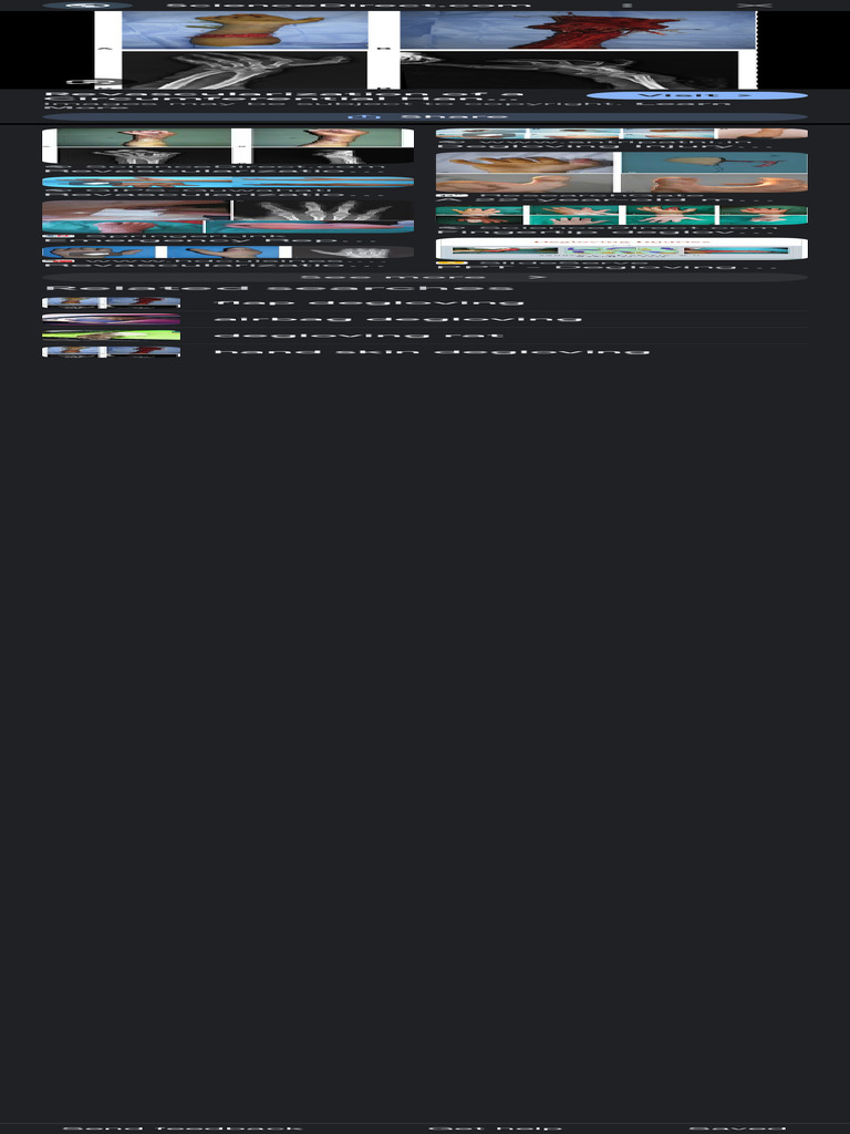 Degloved Arm - Google Search | PDF