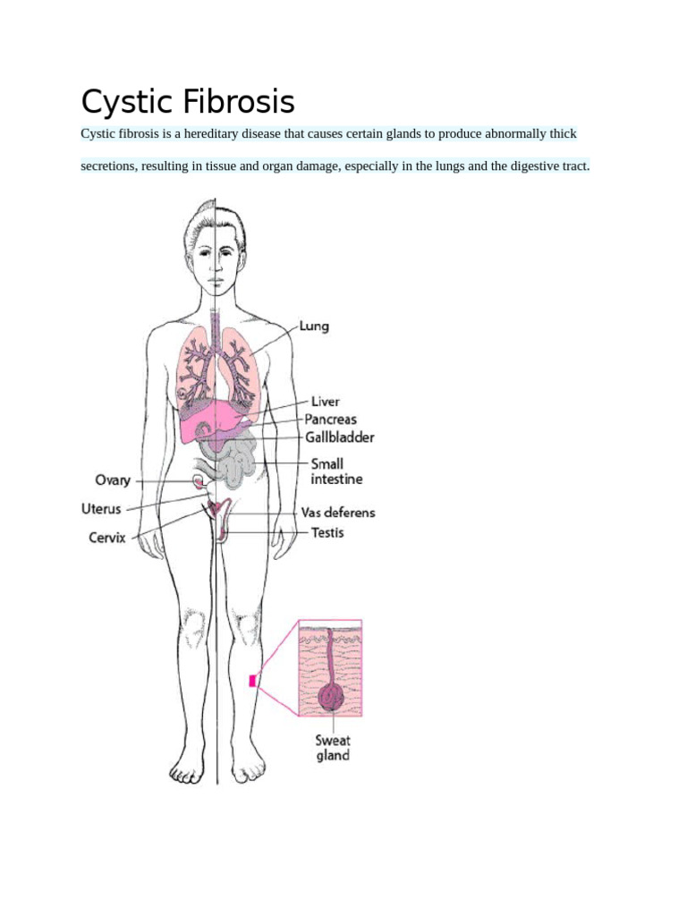 Cystic Fibrosis: Key Facts for Adults | PDF